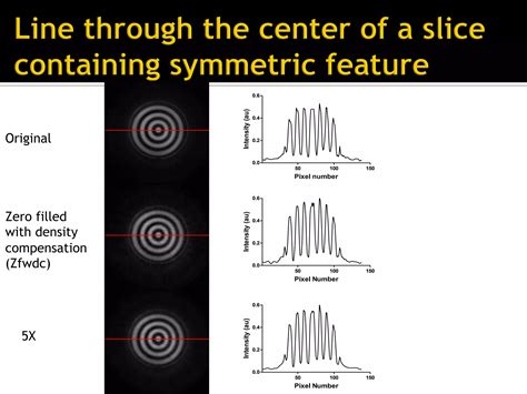 introduction to compressed sensing mri pdf