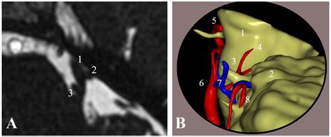 Surgeries Free Full Text Endoscopically Assisted Exoscopic Surgery Surgeries Free Full Text Endoscopically Assisted Exoscopic Surgery