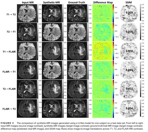 Deep Learning Based Convolutional Neural Network For Intramodality Brain Mri Synthesis