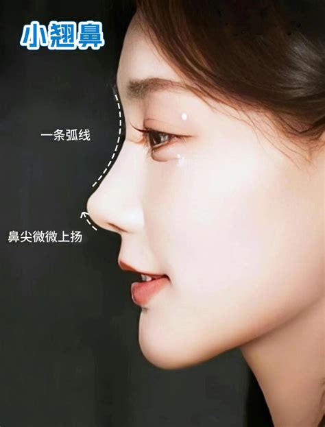 2024年高级鼻的细节点你掌握了吗！ 健康160