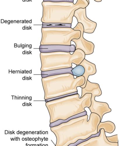 MSK Part Flashcards Quizlet