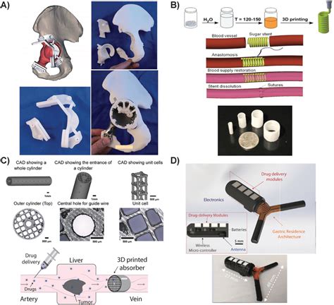Personalized Medical Devices Used In Surgical Planning Or As Download Scientific Diagram