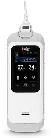 Masimo Rad G