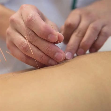 Acupuncture Course Online Diploma Learn The Basics