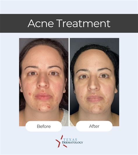 Texas Dermatology Alamo Heights In San Antonio Tx 78218 210 8