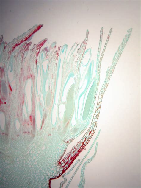 Class Polytrichopsida Introduction To Bryophytes