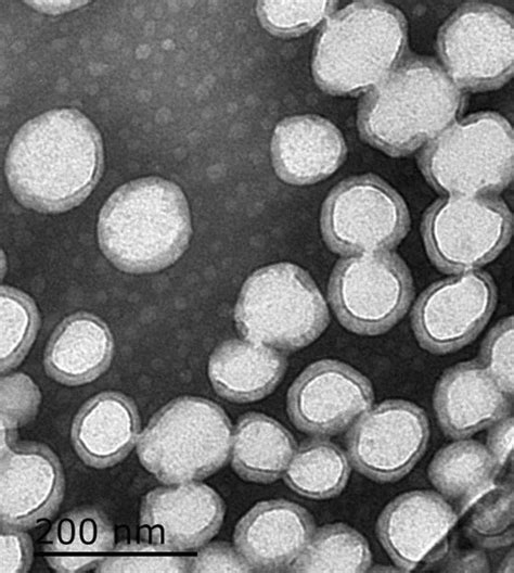Tem Image Of Coreshell Cationic Silicone Acrylic Emulsion Download Scientific Diagram