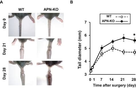 Adiponectin Deficiency Exacerbates Lymphedema In A Mouse Tail Model A