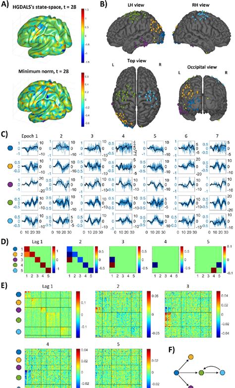 Large Scale Simulation Based On Simulated Meg Data A Hgdalss Top