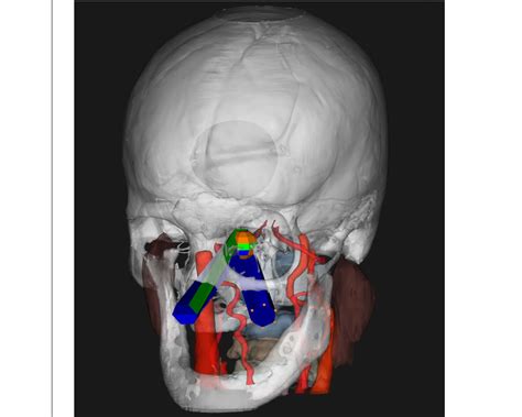 Medical Information Processing Robotic Collaboration And Autonomy Lab Rit