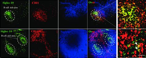 Immunofluorescence Staining Of Siglec 10 Cd21 Double Positive Cells And Download Scientific