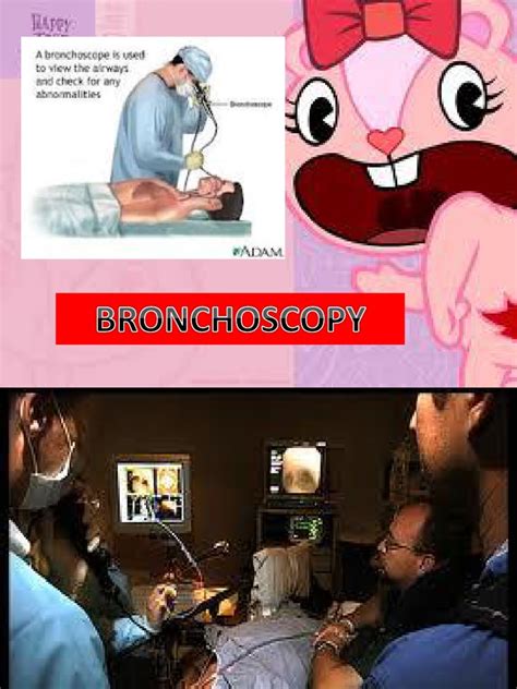 Bronchoscopy Procedures Purposes Types Nursing Responsibilities And Patient Care Pdf