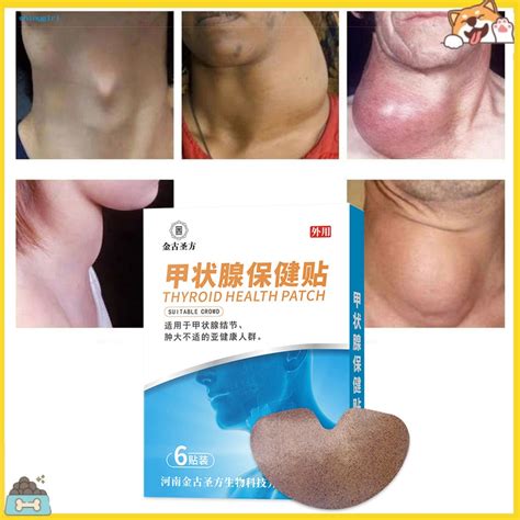 Thyroid Health Patch 6 Stickers In 3 Packsbox To Treat Thyroid Nodule