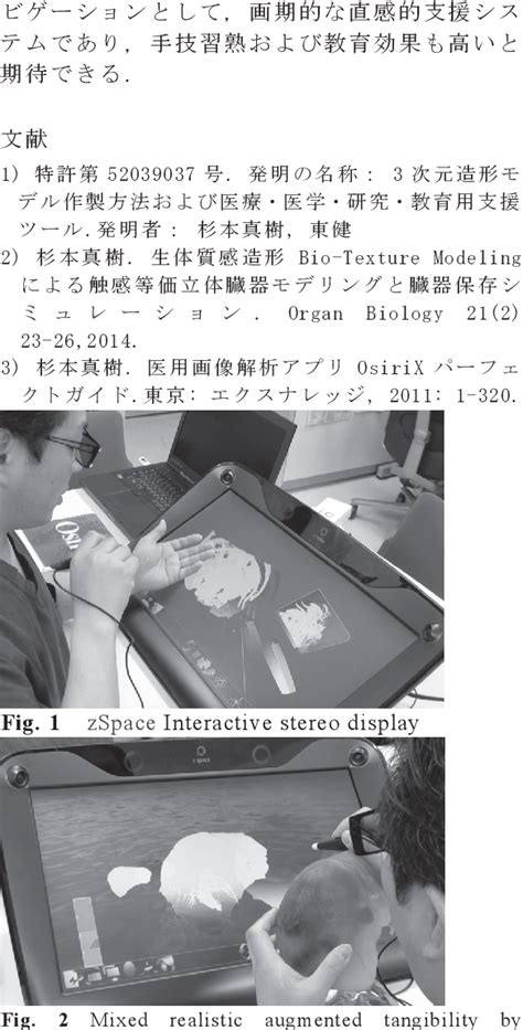 Figure 1 From Evaluation Of Accuracy Of Stem Anteversion In Using