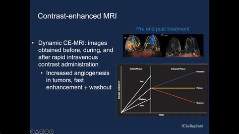 Breast Diffusion Weighted Imaging Cme For Radiologists By Els