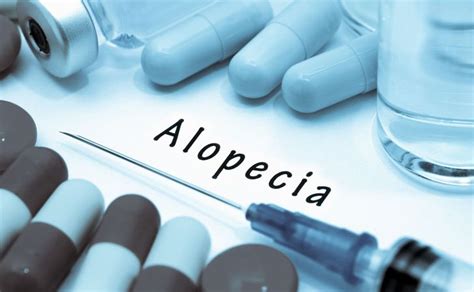 What Is Faga Female Androgenetic Alopecia Causes Of Onset And