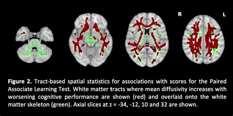 Neuroimaging Correlates Of Cognitive Deficits In Wilsons Disease Mds Abstracts