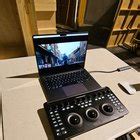 Constant Error Retrieving Frame Frame Substitution Recursion Errors On A Brand New