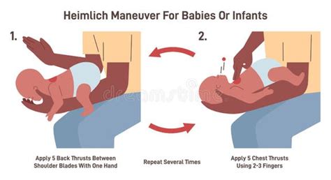 Choking First Aid. Heimlich Maneuver Procedure To Remove a Foreign Stock Vector - Illustration ...
