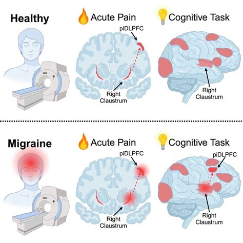 A Mysterious Brain Region Contributes To Aberrant Cognitive Processing