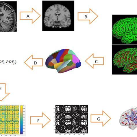 The General Flowchart Of Structural Brain Network Construction