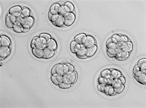 Understanding Ivf Embryo Grading Systems Arc® Fertility