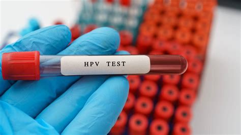 Cms Designates Hpv Test As An Advanced Diagnostic Lab Test Clinical