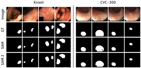 [논문 리뷰] Polyp Sam 2 Advancing Zero Shot Polyp Segmentation In Colorectal Cancer Detection