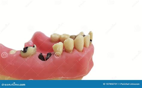 Dentoform Dental Teeth Model Stock Image 48878641