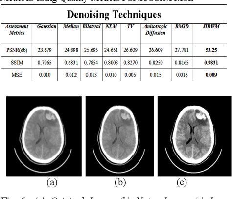 Table 1 From Hybrid Discrete Wavelet Enhancement Model For Brain Ncct Images Semantic Scholar