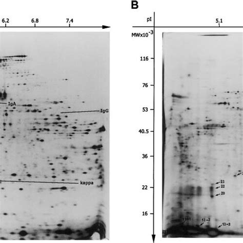 The 2 De Of The Soluble And Membrane Bound Protein Fractions From The