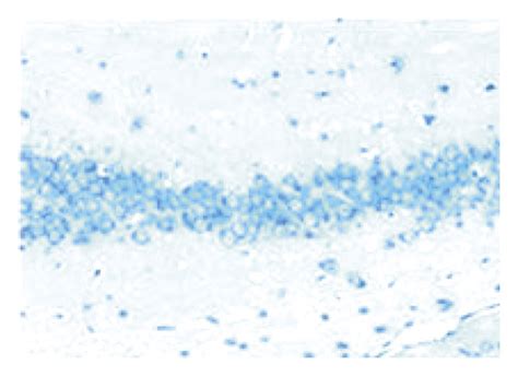 Influence Of Texture Parameters On Friction Factor At Different Download Scientific Diagram