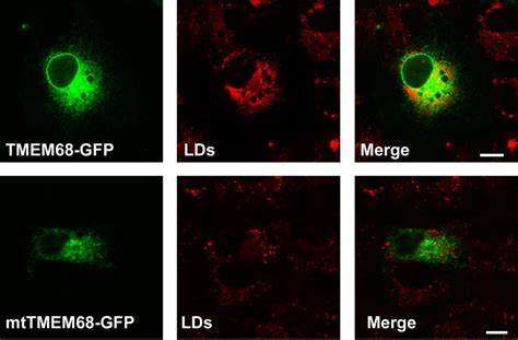 Tmem68 Expression Increases Lds Content Mcf 7 Cells Were Transfected