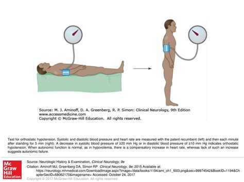 Test For Orthostatic Hypotension Ppt Download Artofit