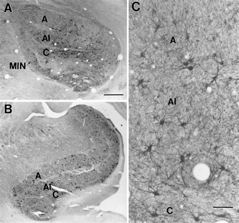 Figure 1 From Neurofilament Proteins In Y Cells Of The Cat Lateral