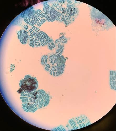 Cyanobacteria Flashcards Quizlet