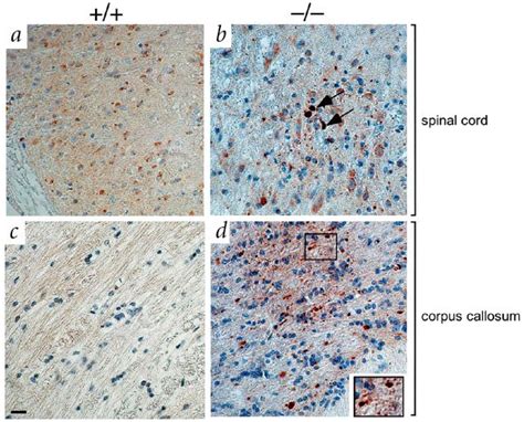 Disruption Of Cnp1 Uncouples Oligodendroglial Functions In Axonal