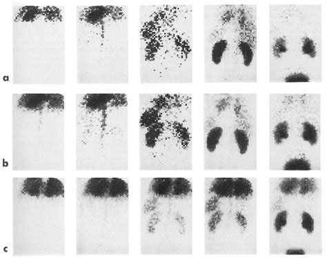 Figure 1 From Production Of Dynamic Persistence Displays Using A Computer Semantic Scholar