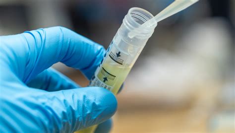 Explore Our Lab Tests Labcorp Ondemand