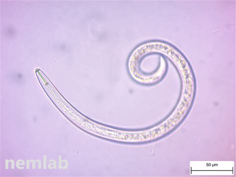 Spiral Nematode Definition At Cynthia Heather Blog