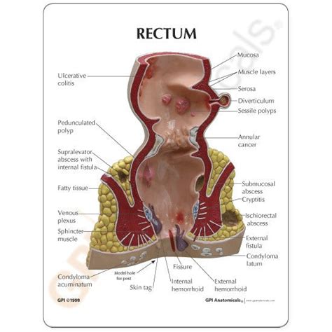 Digestive System Models And Anatomy Posters Page 2 Anatomystuff