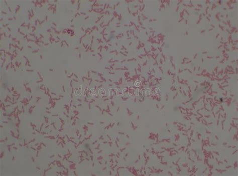 Gram Negative Bacilli With Bipolar Stain Bacteriaburkholderia