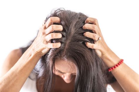 Scalp Acne How To Treat Pimples On Your Scalp