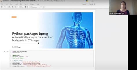 Sarah Schuhegger On Linkedin Machinelearning Python Computervision