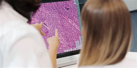 How Is Total Magnification Calculated For Digital Microscope