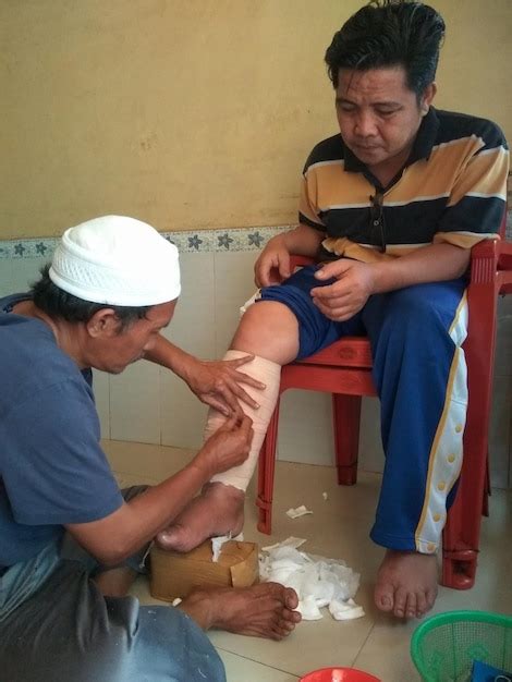 Premium Photo Traditional Fracture Treatment Without Doing Operation
