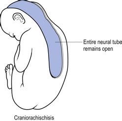 Early Developmental Events Clinical Gateclinical Gate
