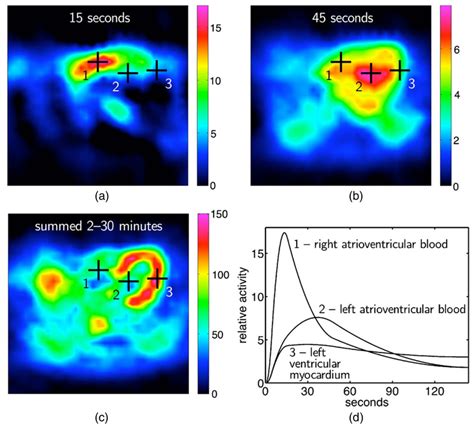 Estimation Of Timeactivity Curves From Projections Acquired With Slow Download Scientific