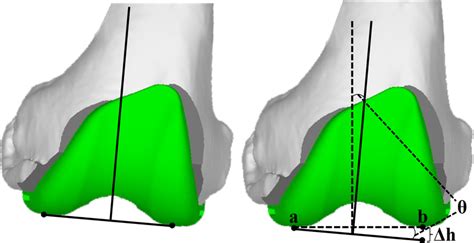 Schematic Diagram Of The Relationship Between Gap And Alignment By