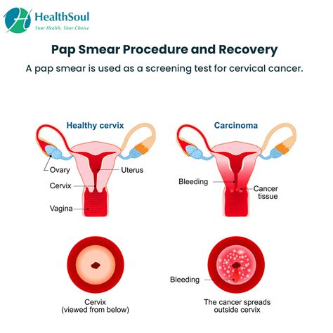 Pap Smear Guidelines 2024 Darb Minnie